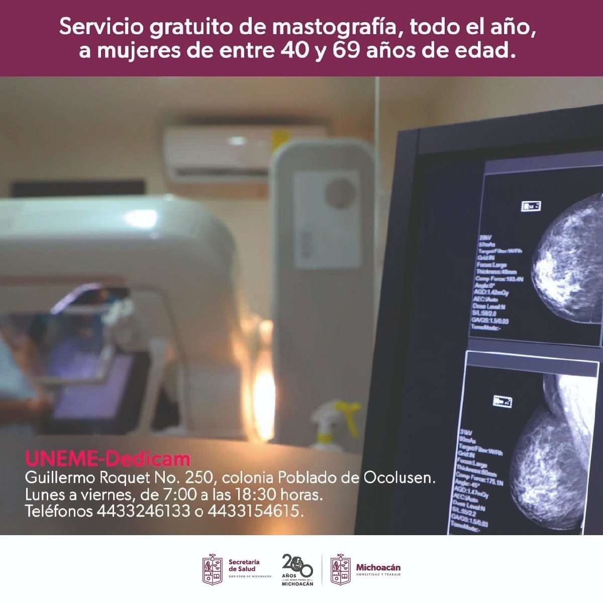 Solicita una mastografía gratuita en la unidad de cáncer de mama de Morelia